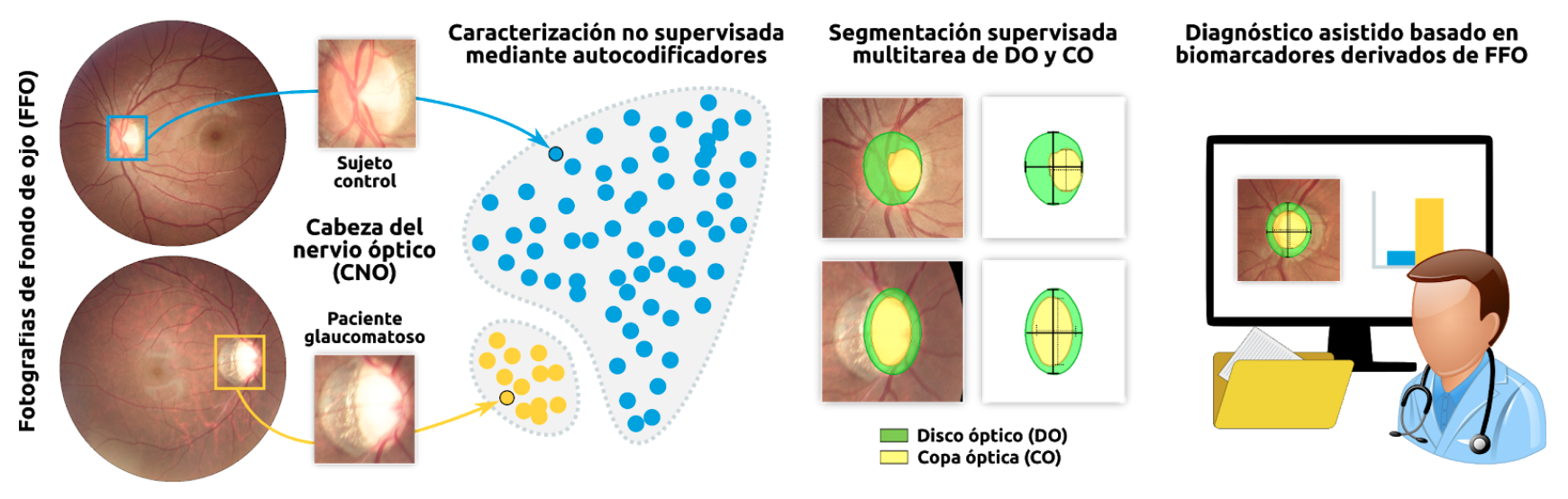 Towards a better understanding of glaucoma through fundus photography ...