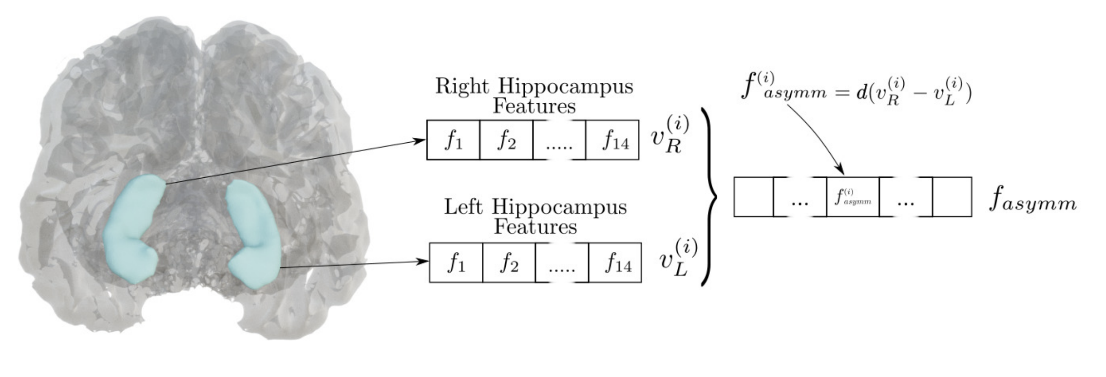 NORHA: A NORmal Hippocampal Asymmetry deviation index based on one-class novelty detection and ...
