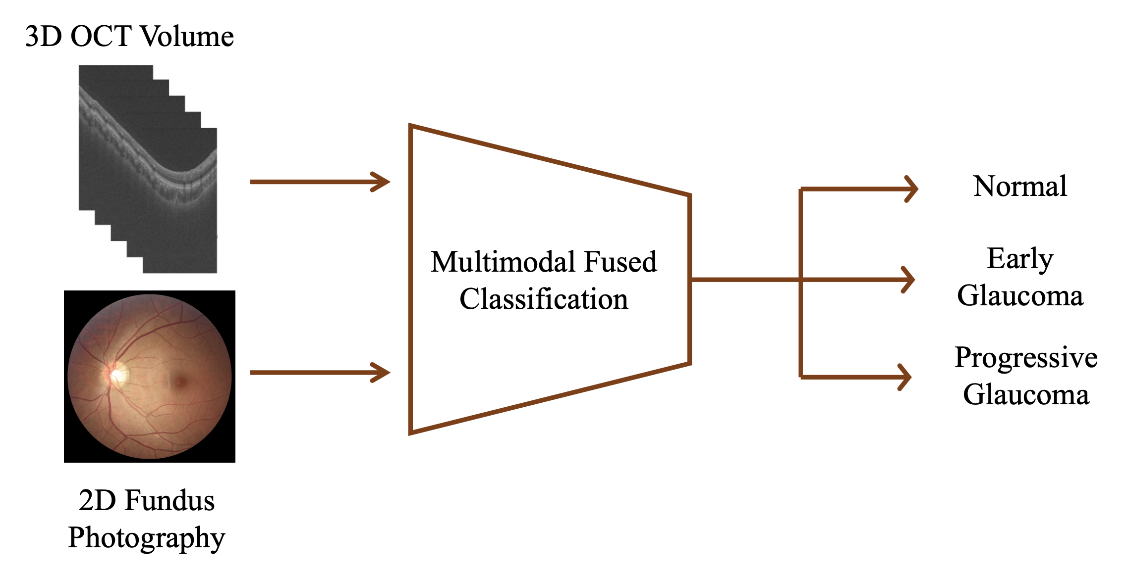 GAMMA challenge: Glaucoma grAding from Multi-Modality imAges | José Ignacio Orlando